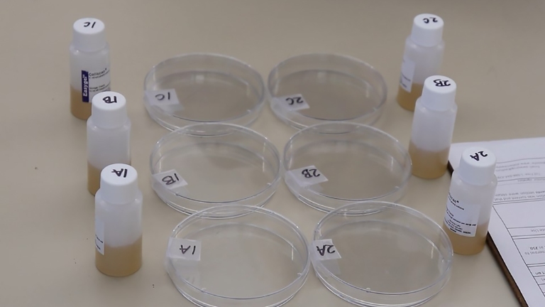Bacteriological Monitoring